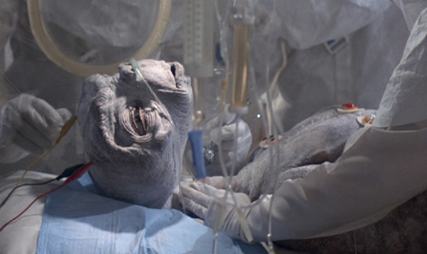 Et The Extra Terrestrial Sick E.T.